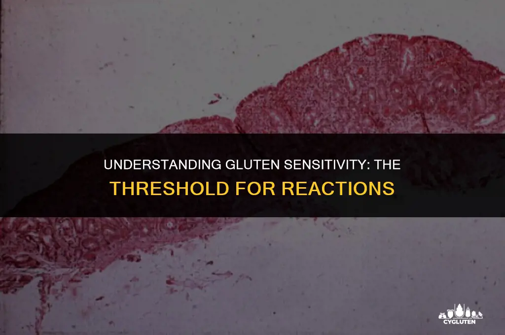 Understanding Gluten Sensitivity: The Threshold For Reactions | CyGluten